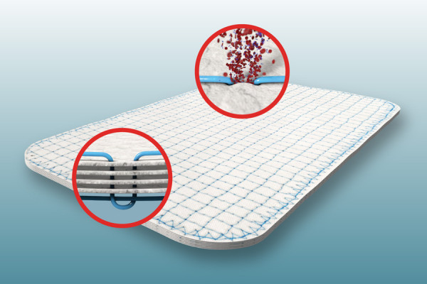 How TELA Bio Is Working to Improve Surgical Mesh Options